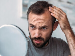 Can Low Testosterone Cause Hair Loss? Treatment And Myths